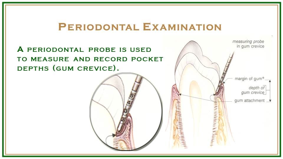 Gum Disease (Periodontal Disease) | Dr. Marvin B. Budd | Periodontist ...
